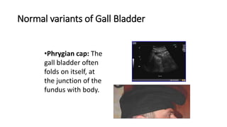 Radiological anatomy of hepatobiliary system | PPTX