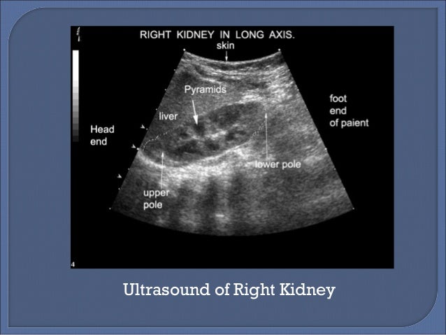 Radiological anatomy of kidney, ureter & bladder