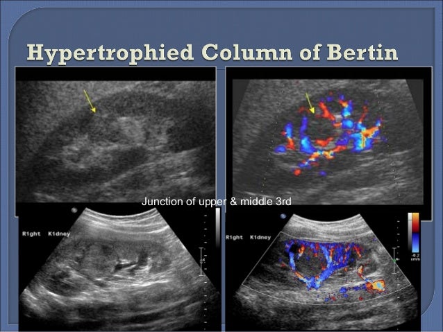 Radiological anatomy of kidney, ureter & bladder