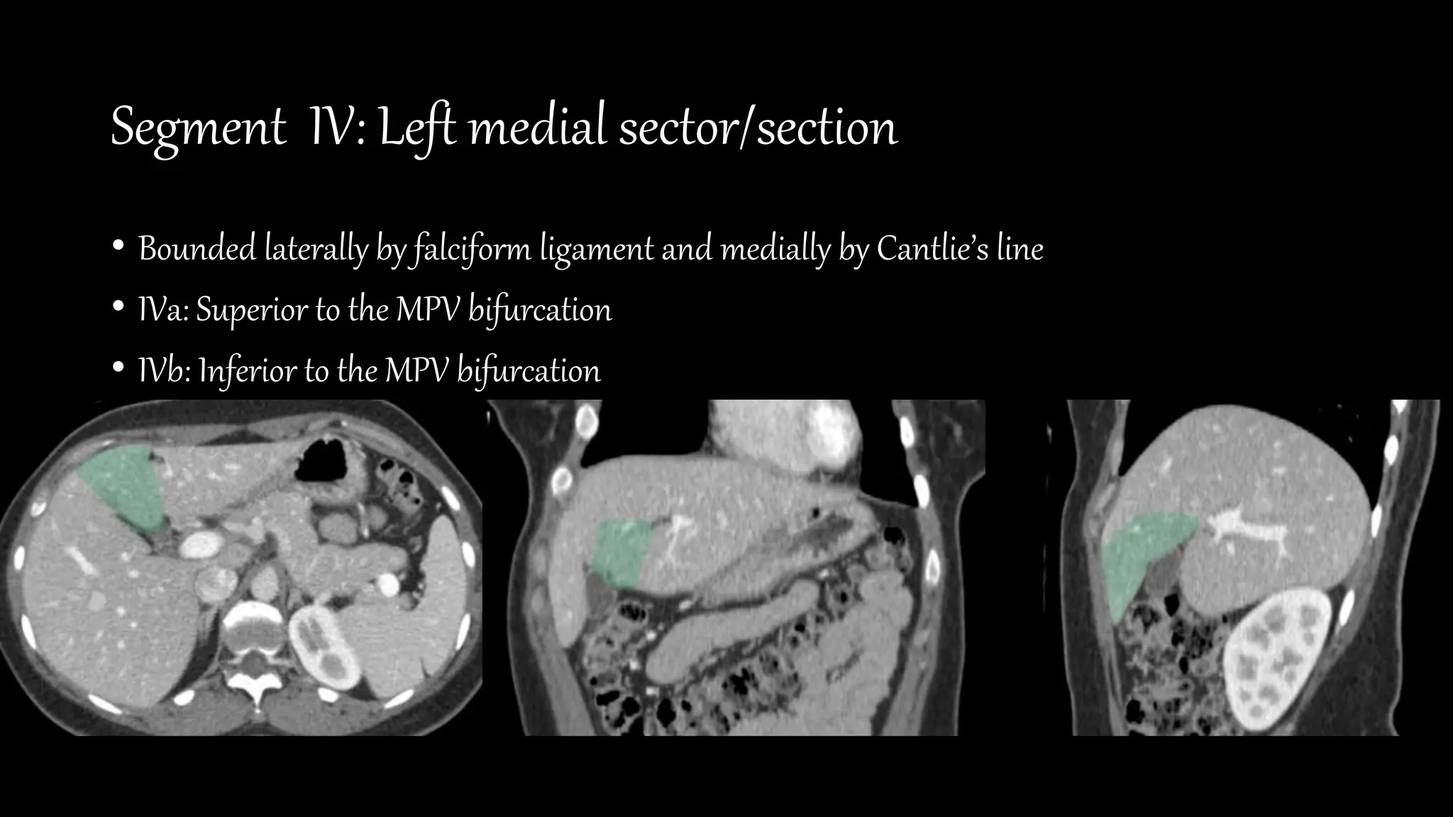 Radiological anatomy of human liver.pptx