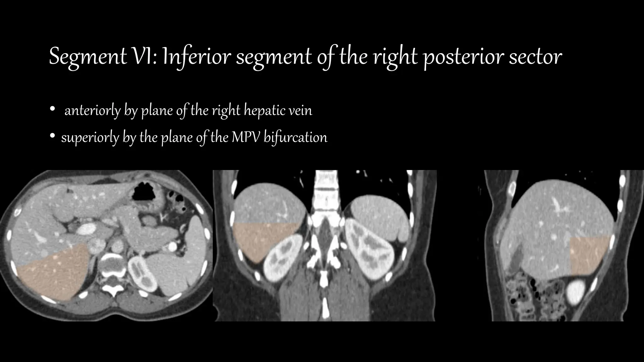 Radiological anatomy of human liver.pptx
