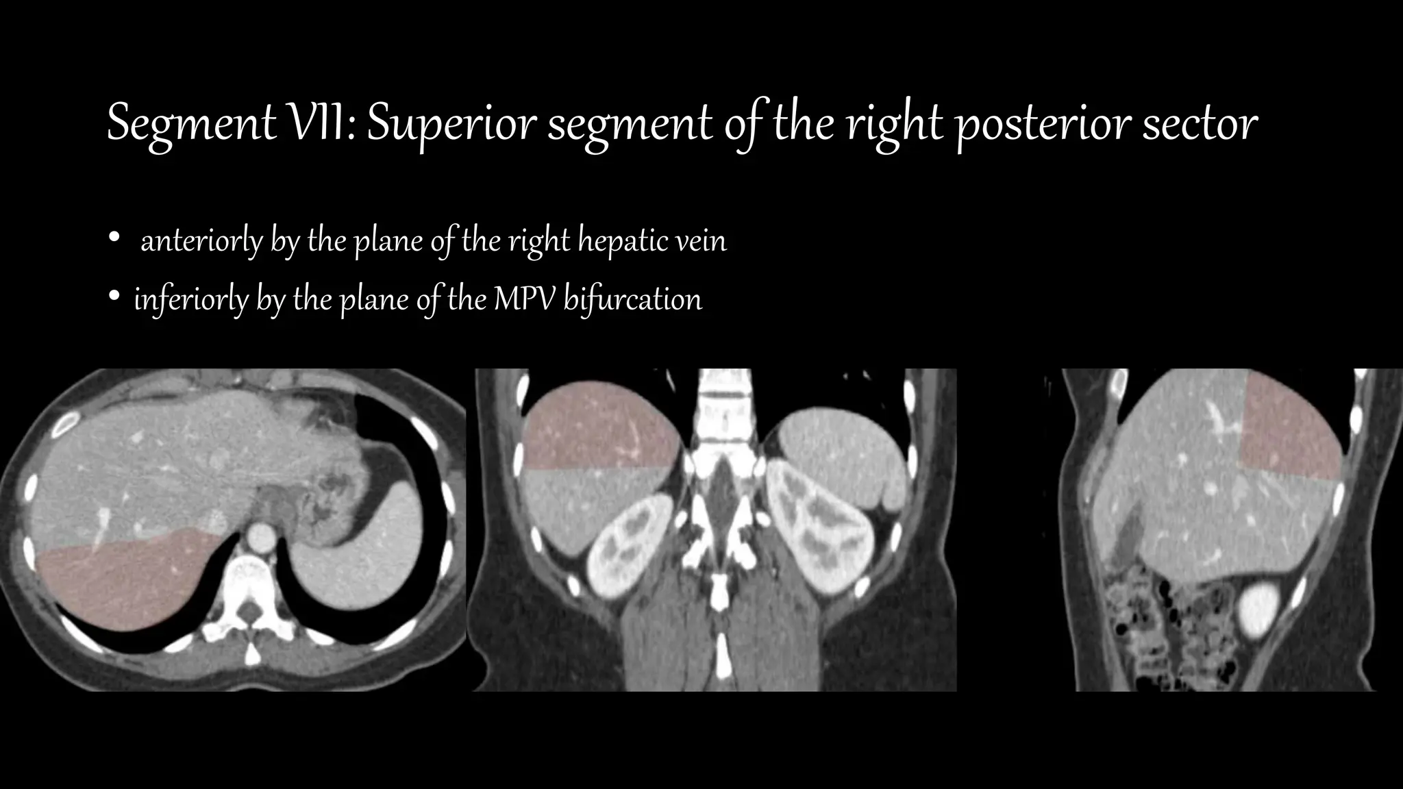 Radiological anatomy of human liver.pptx