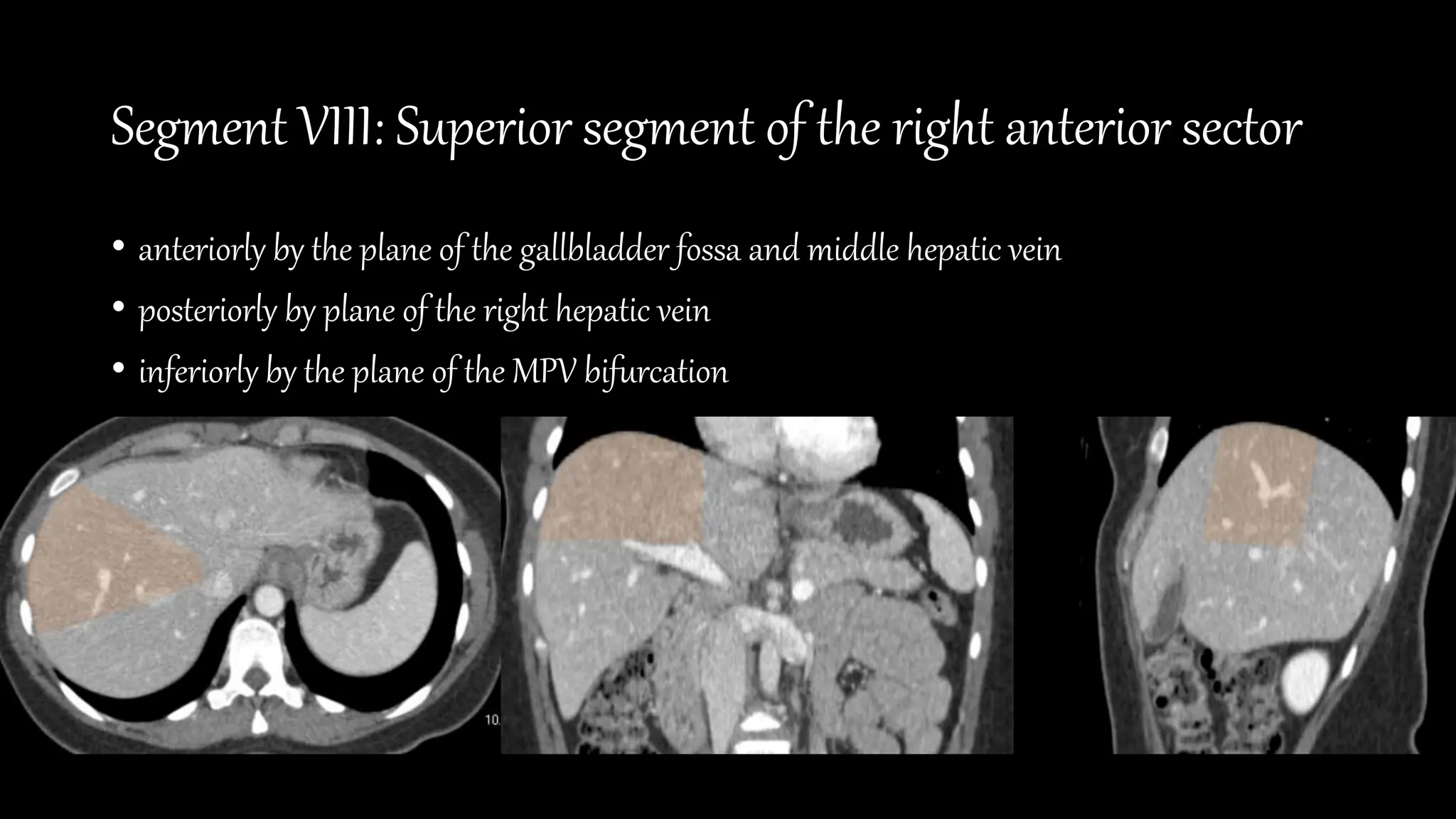 Radiological anatomy of human liver.pptx