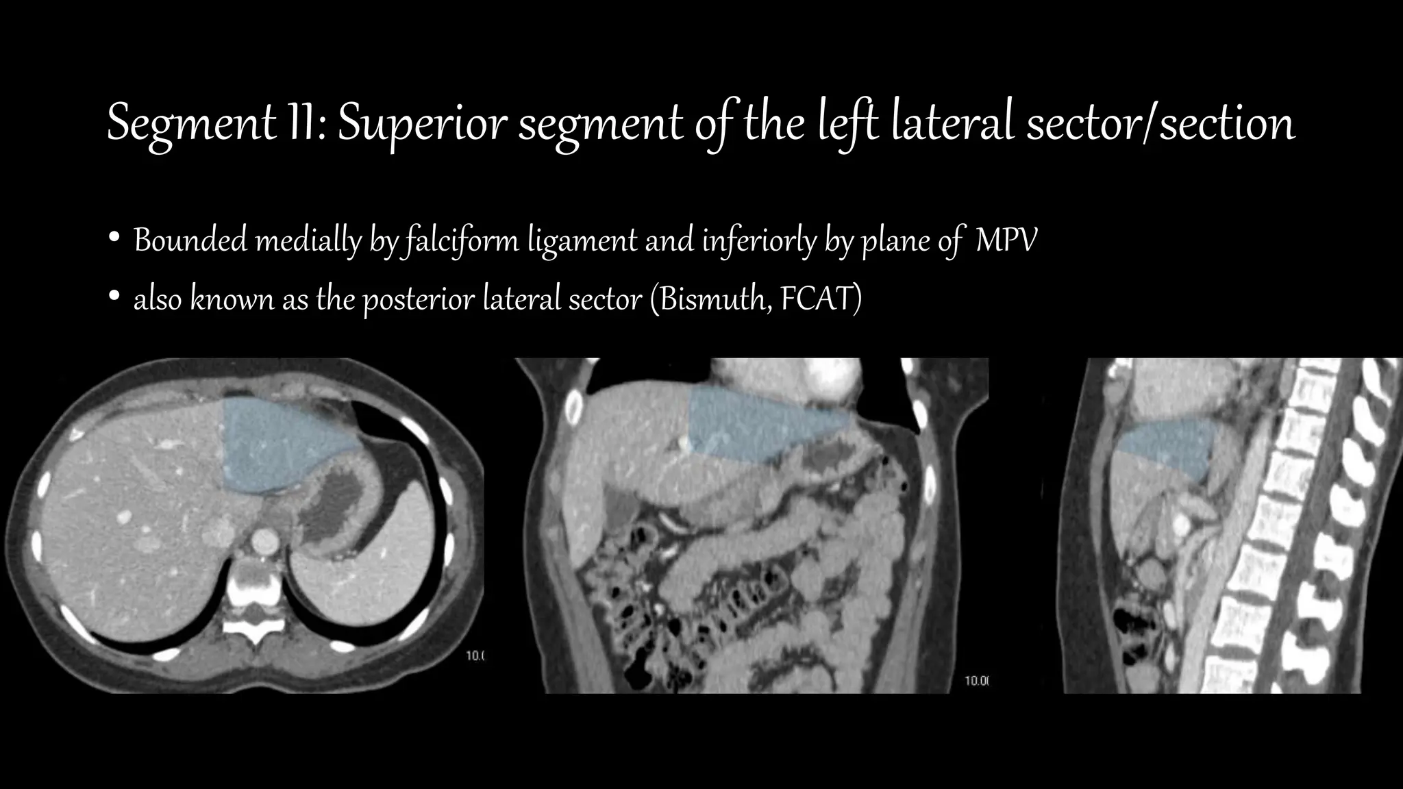 Radiological anatomy of human liver.pptx