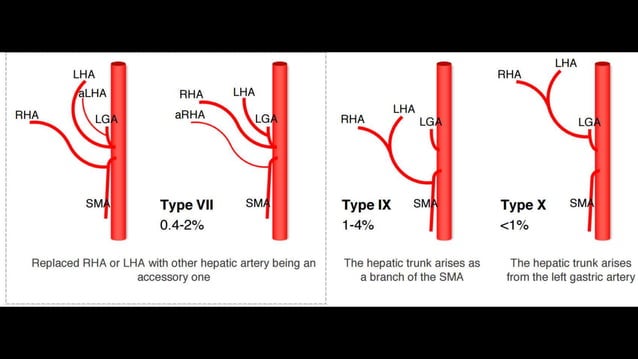 Radiological anatomy of human liver.pptx