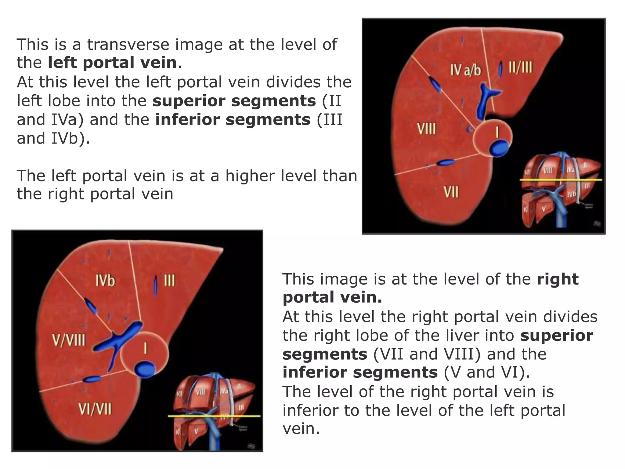 Segmental Anatomy of Liver and its Radiological Correlation | PPTX