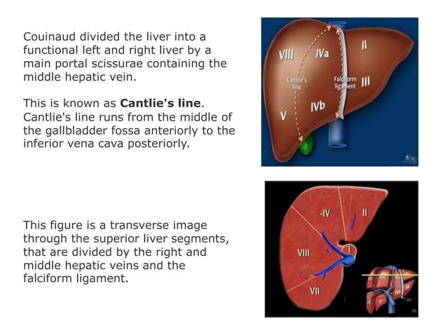 Segmental Anatomy of Liver and its Radiological Correlation | PPTX ...