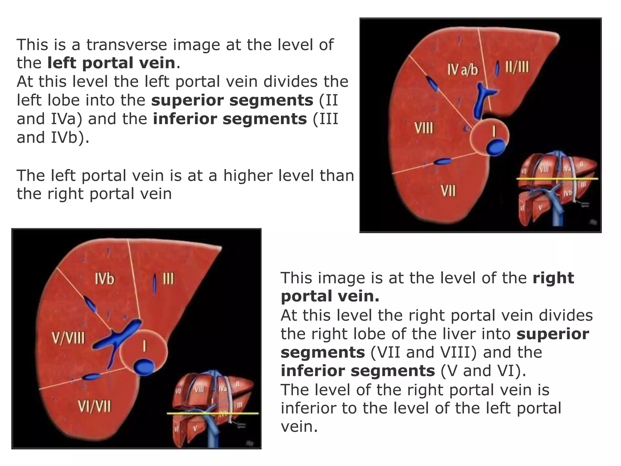 radiological anatomy of liver segments (1).pptx