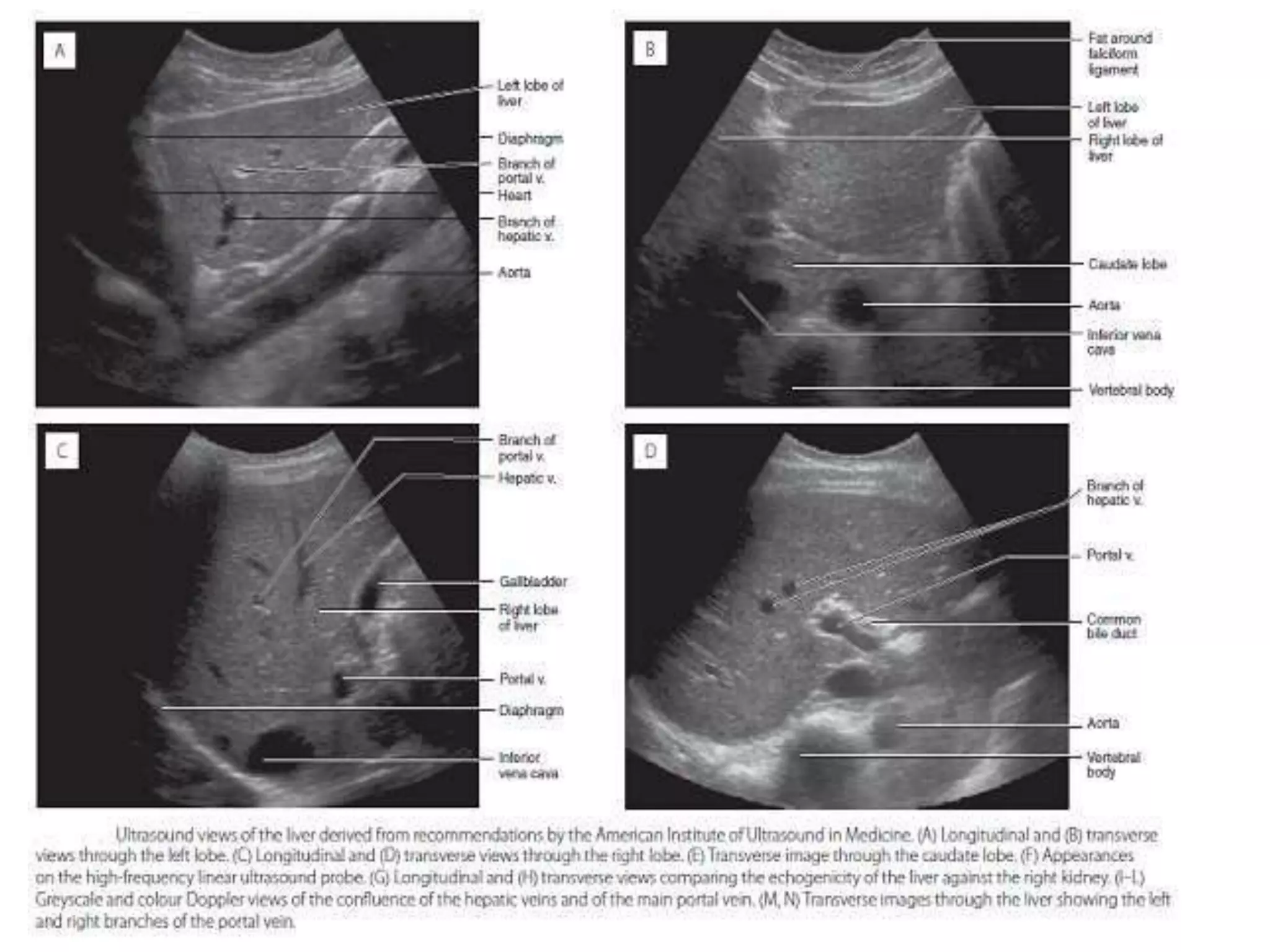 radiological anatomy of liver segments (1).pptx