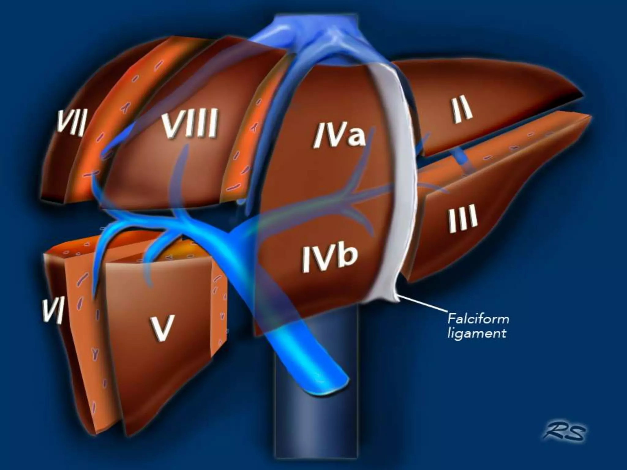 radiological anatomy of liver segments (1).pptx