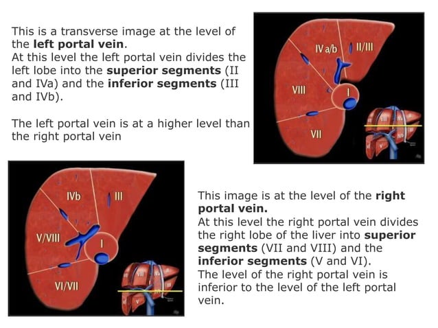 radiological anatomy of liver segments (1).pptx | Endocrine and Metabolic Diseases | Diseases ...