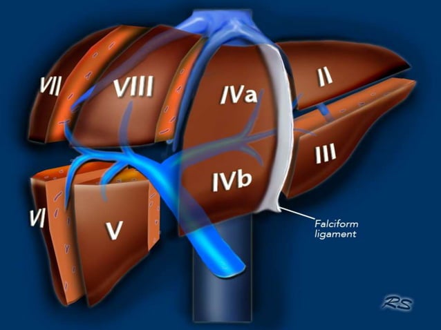 radiological anatomy of liver segments (1).pptx | Endocrine and ...