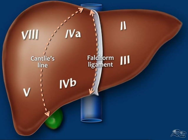 radiological anatomy of liver segments (1).pptx | Endocrine and ...