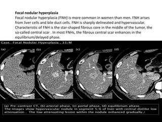 radiological anatomy of liver segments (1).pptx