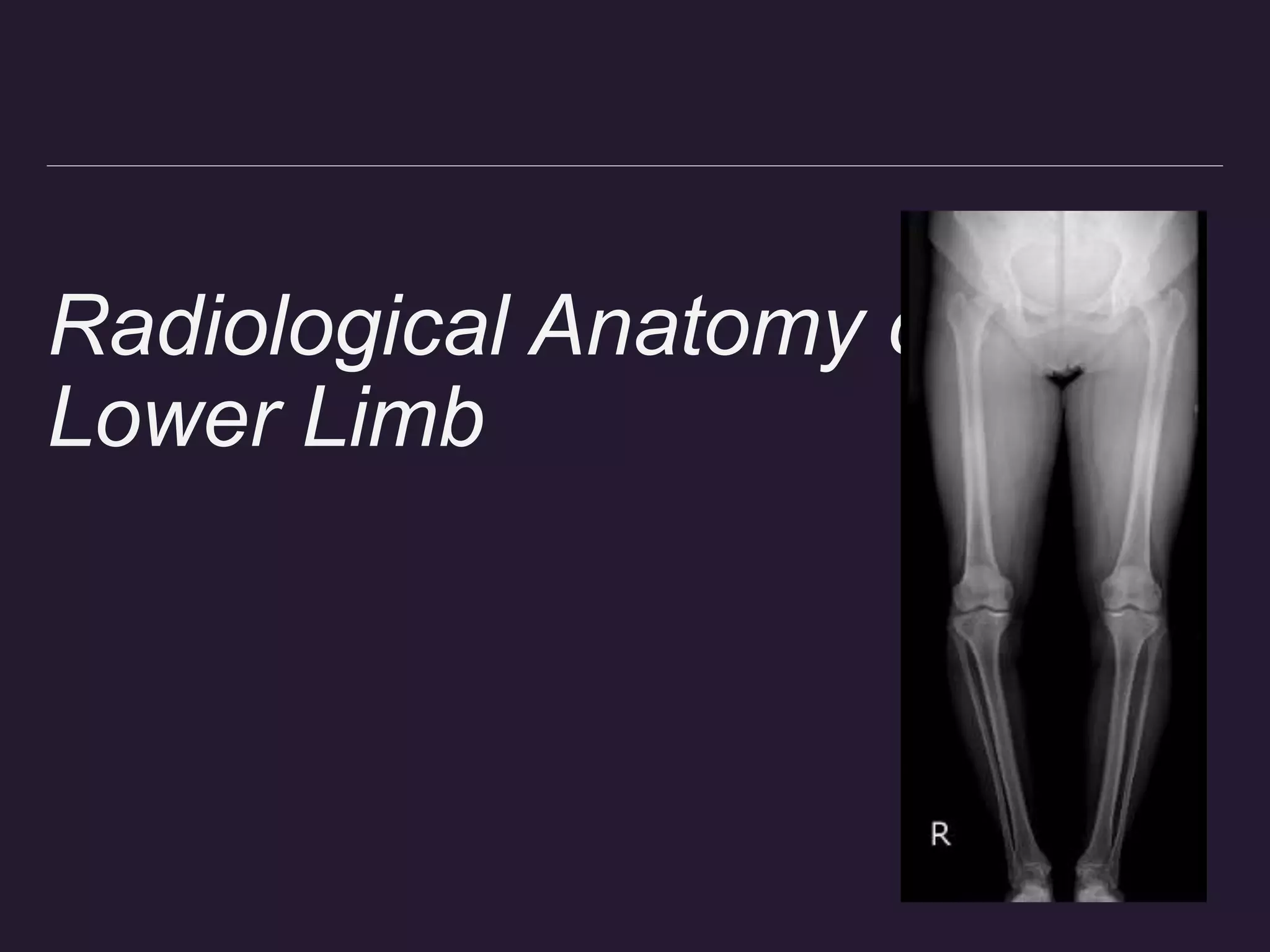 Lower Limb Bones Ppt