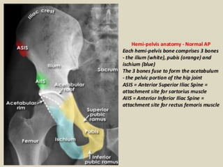 Radiological anatomy of lower limb | PPTX