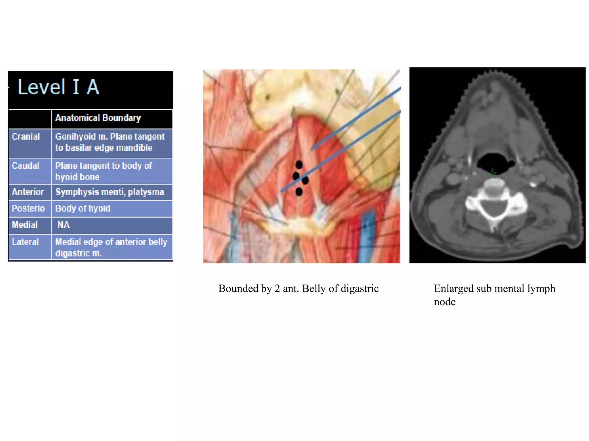 Radiological anatomy of lymph node | PPTX