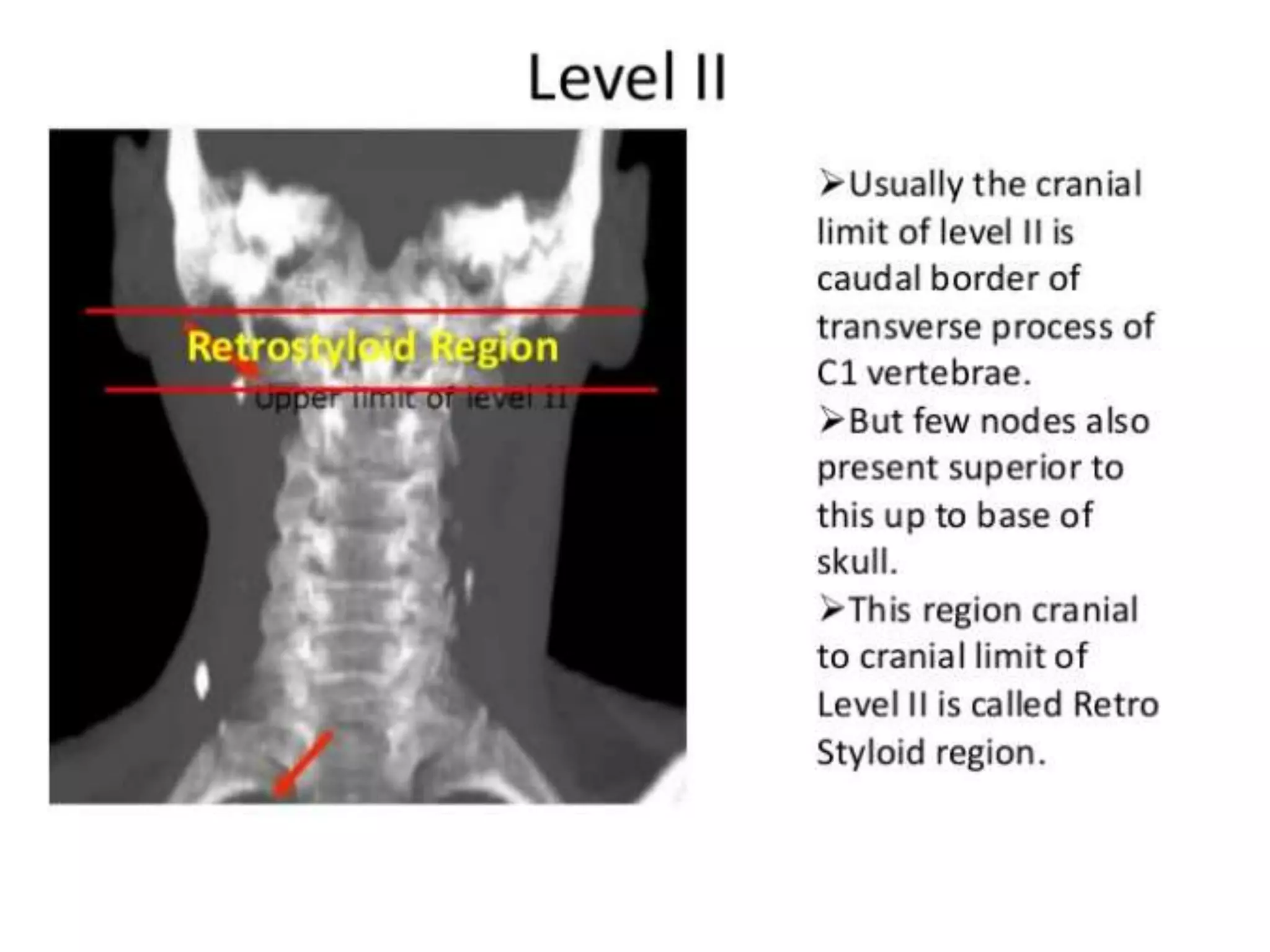 Radiological anatomy of lymph node | PPTX | Ear, Nose and Throat ...
