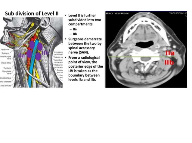 Radiological anatomy of lymph node | PPTX | Ear, Nose and Throat ...
