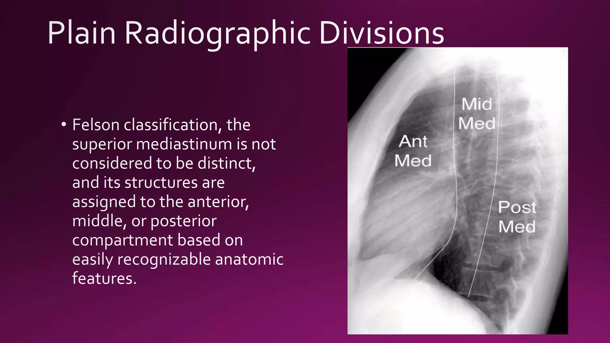 Radiological anatomy of mediastinum | PPTX
