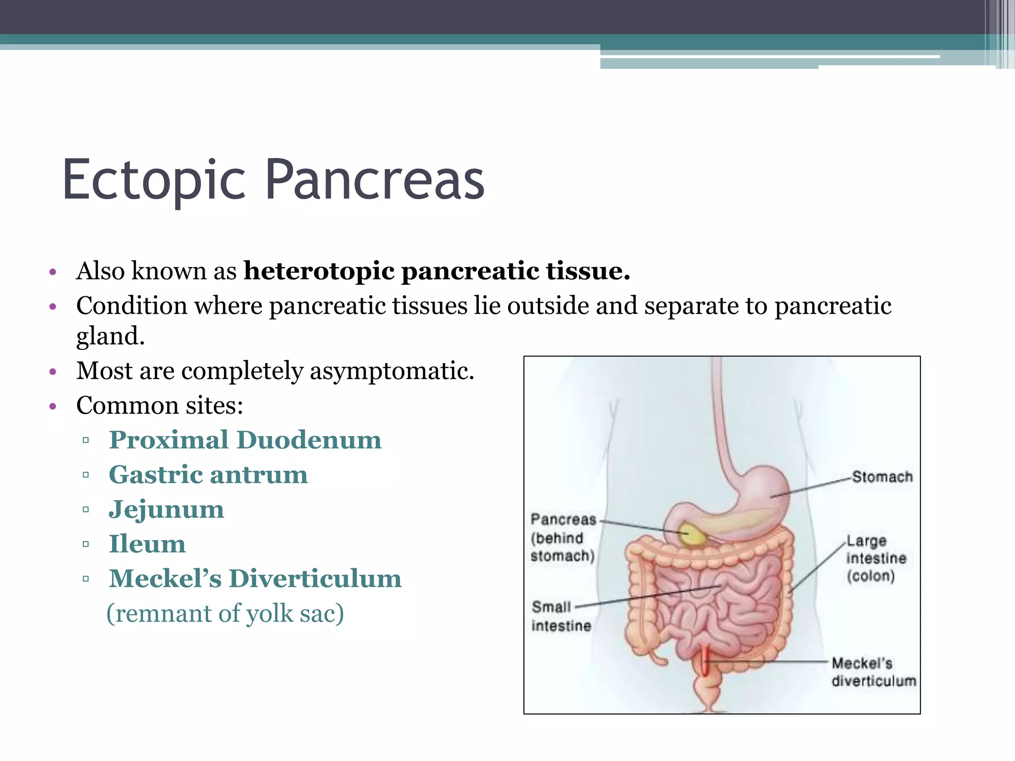 Radiological anatomy of pancreas and spleen | PPTX