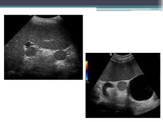 Radiological anatomy of pancreas and spleen | PPTX