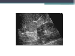 Radiological anatomy of pancreas and spleen | PPTX