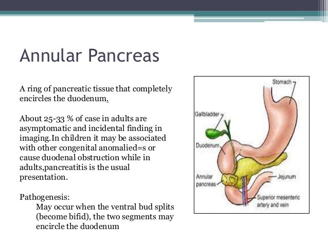 Radiological anatomy of pancreas and spleen