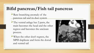 Radiological anatomy of Pancreas and Spleen | PPTX
