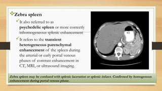 Radiological anatomy of Pancreas and Spleen | PPTX