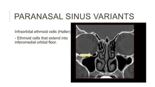 RADIOLOGICAL ANATOMY OF PNS Dr Pierre.pptx