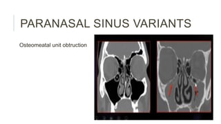 RADIOLOGICAL ANATOMY OF PNS Dr Pierre.pptx
