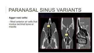 RADIOLOGICAL ANATOMY OF PNS Dr Pierre.pptx