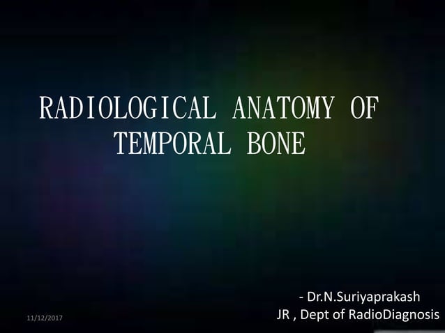 Radiological anatomy of_temporal_bone[1] | PPTX