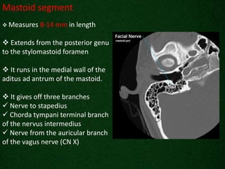 Radiological anatomy of_temporal_bone[1] | PPTX