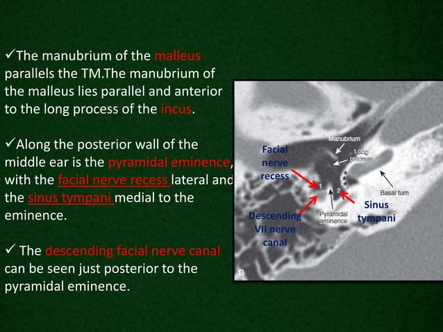 Radiological anatomy of_temporal_bone[1] | PPTX