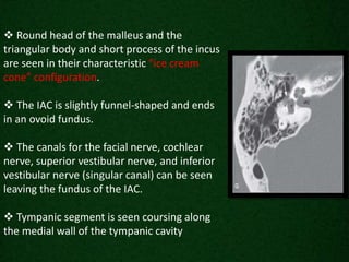 Radiological anatomy of_temporal_bone[1] | PPTX