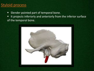 Radiological anatomy of_temporal_bone[1] | PPTX