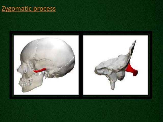 Radiological anatomy of_temporal_bone[1] | PPTX