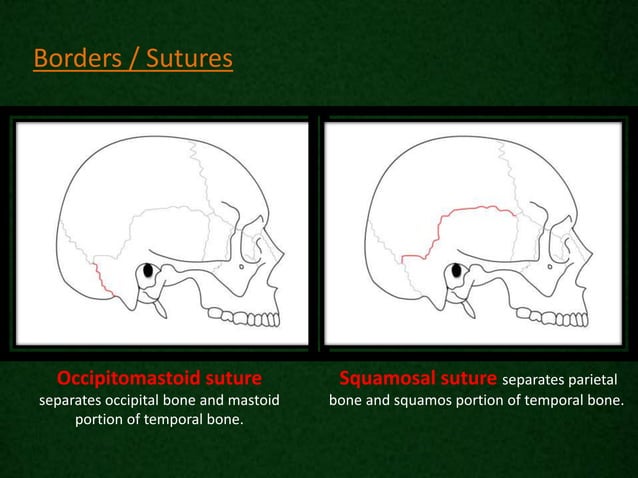 Radiological anatomy of_temporal_bone[1] | PPTX