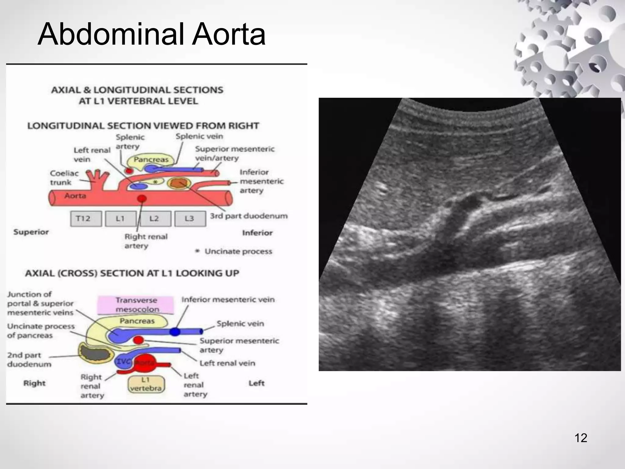 Radiological anatomy of the abdominal aorta | PPTX