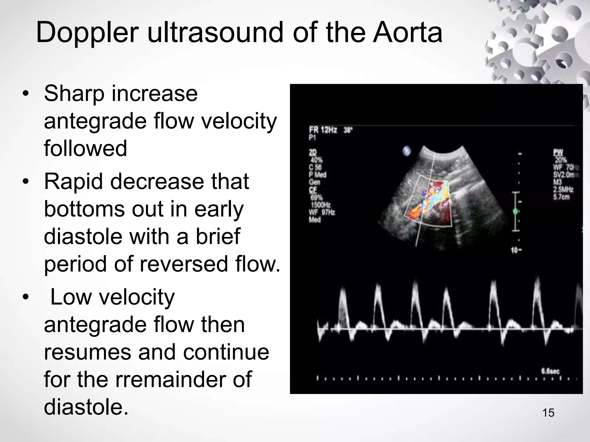 Radiological anatomy of the abdominal aorta | PPTX