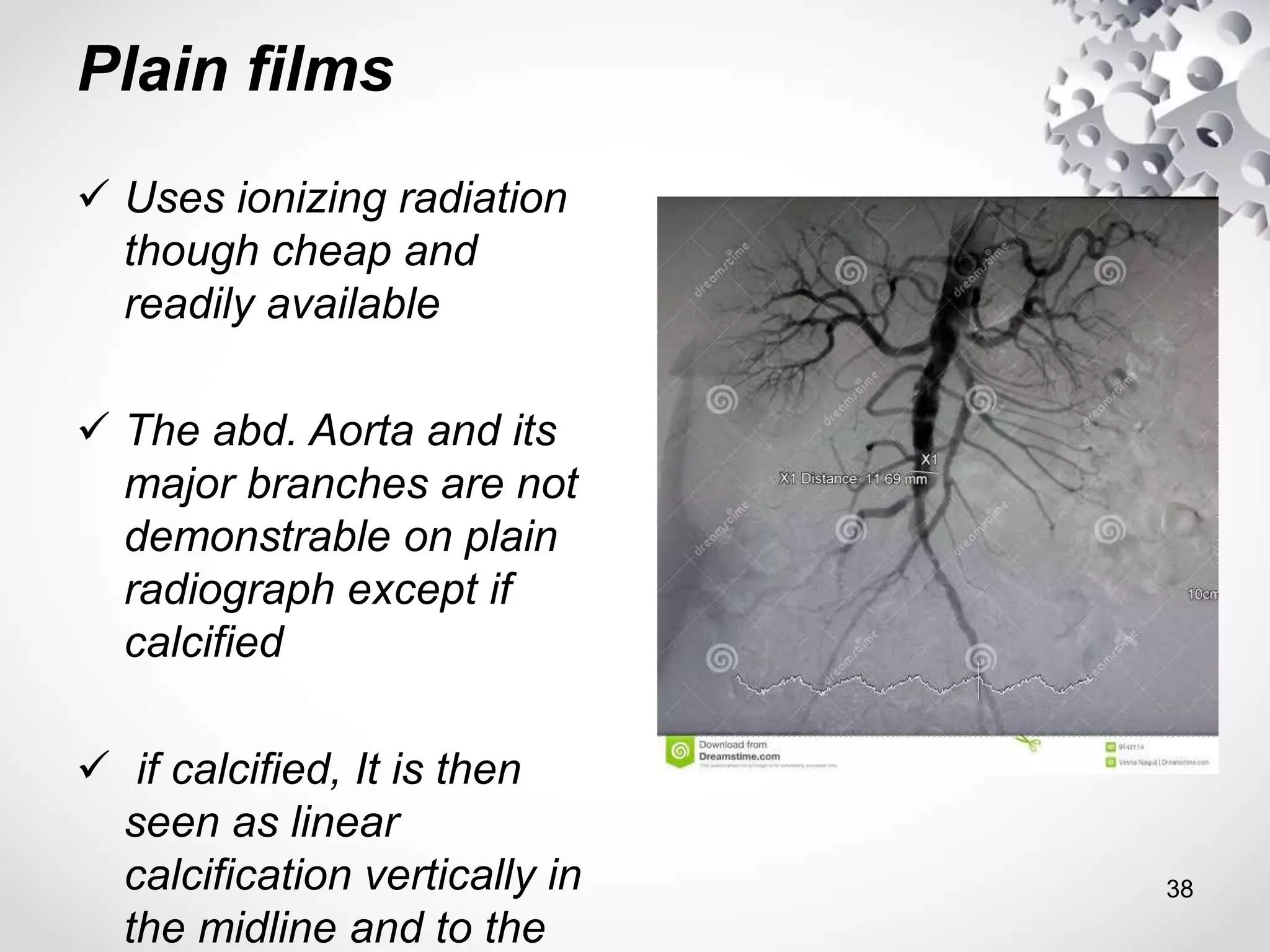 Radiological anatomy of the abdominal aorta | PPTX