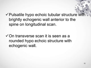 Radiological anatomy of the abdominal aorta | PPTX