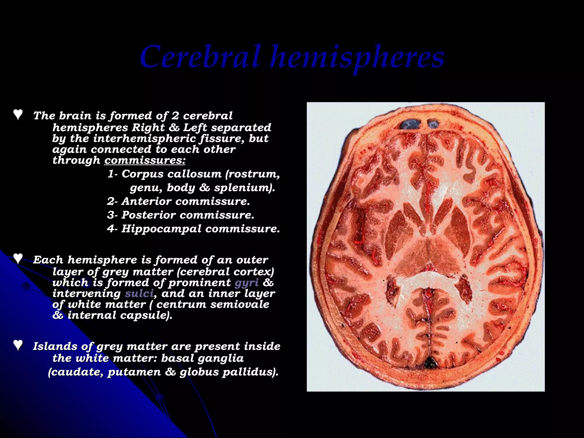 Radiological anatomy of the brain | PPT