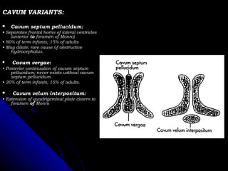 Radiological anatomy of the brain | PPT