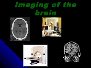 Radiological anatomy of the brain | PPT