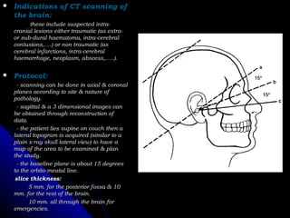 Radiological anatomy of the brain | PPT