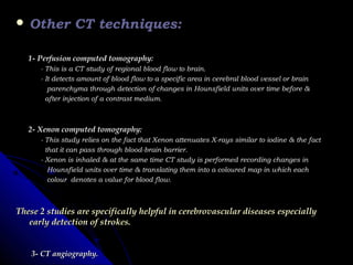 Radiological anatomy of the brain | PPT