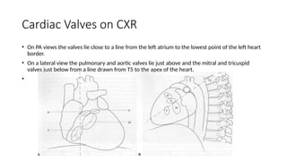 Radiological Anatomy Of the heart and great vessels.pptx